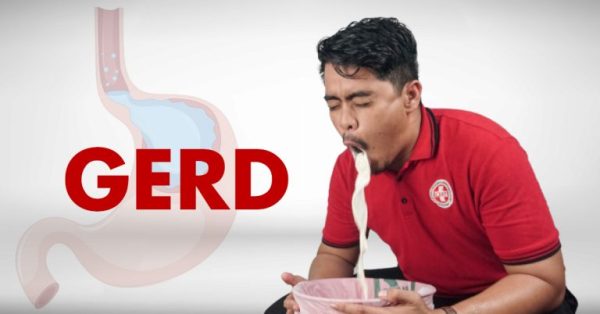 Gerd, Basic Life Support, and Its Significance in Malaysia - CERT Academy